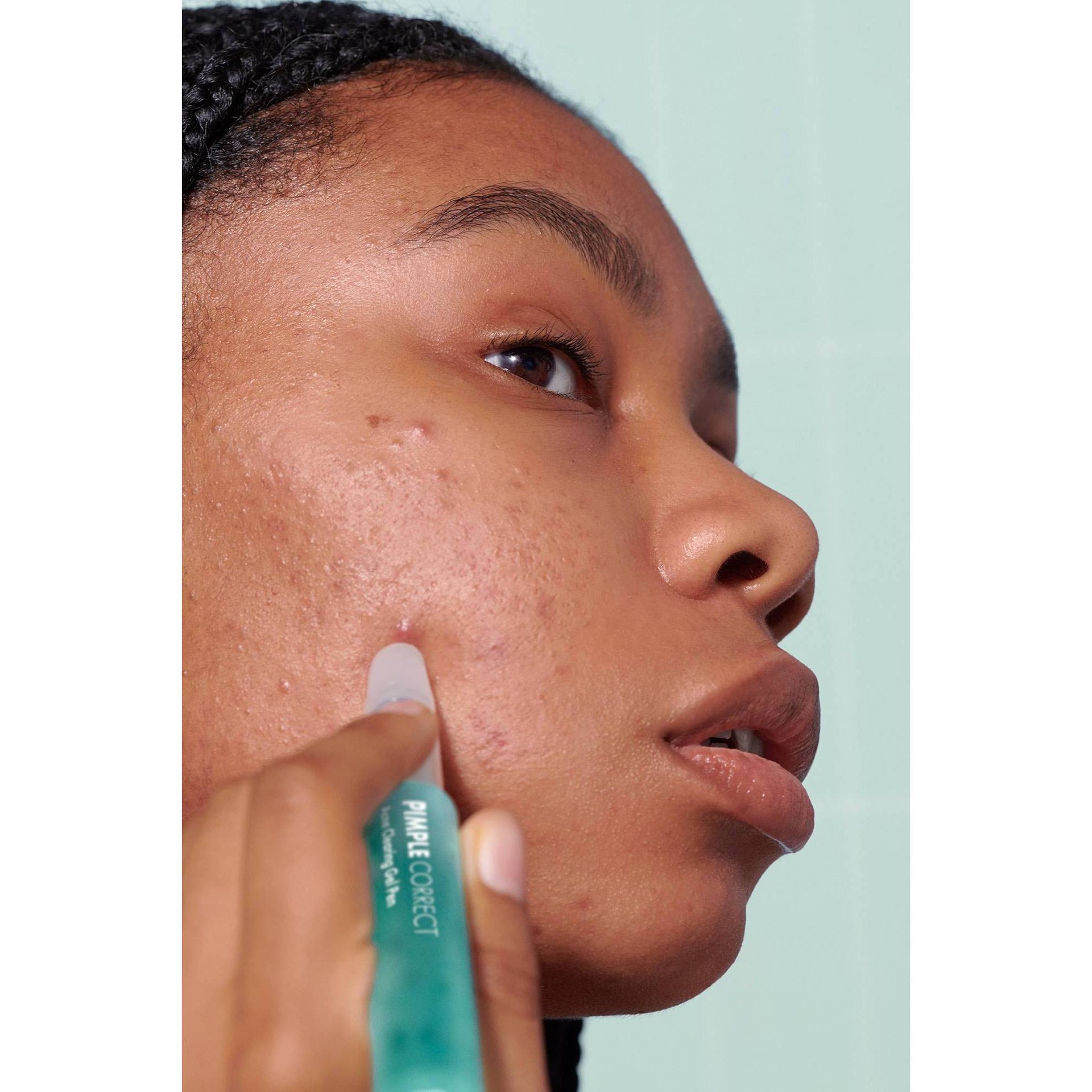 Hero Cosmetics Pimple Correct Acne Clearing Gel Pen - 0.34 fl oz 0.34 ... Hero Cosmetics Pimple Correct Acne Clearing Gel Pen - 0.34 fl oz 0.34 ...